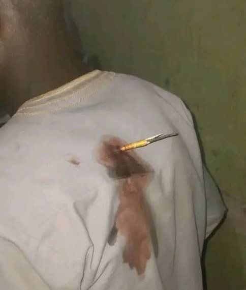 12 Injured As Suspected Herders Attack Jigawa Community - Trending News
